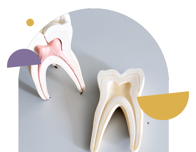 Root Canal Treatment Dromana | Dromana Dental Clinic VIC